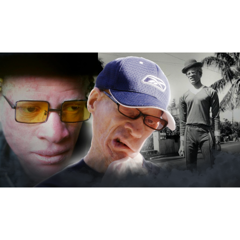 Yellowman's Epic Dancehall Reign: From Struggles to Stardom - I Never ...